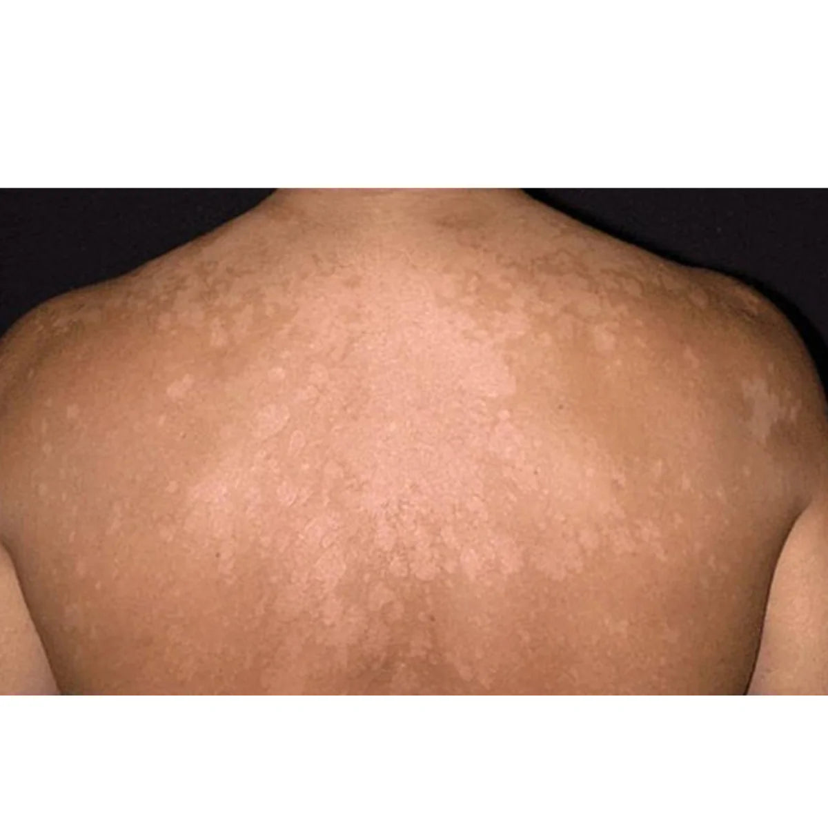 Problèmes Cutanés et Réparation de la Peau – Siam Marketplace